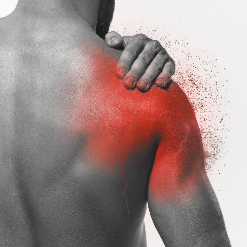 What Is Trapped Nerve & How Can A Chiroprator Help?